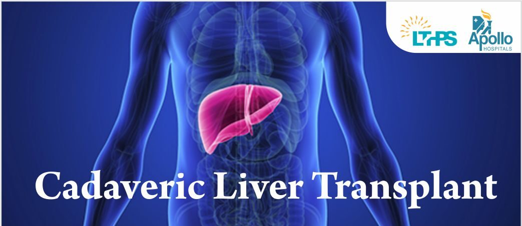 Cadaveric Liver Transplant: What you need to know