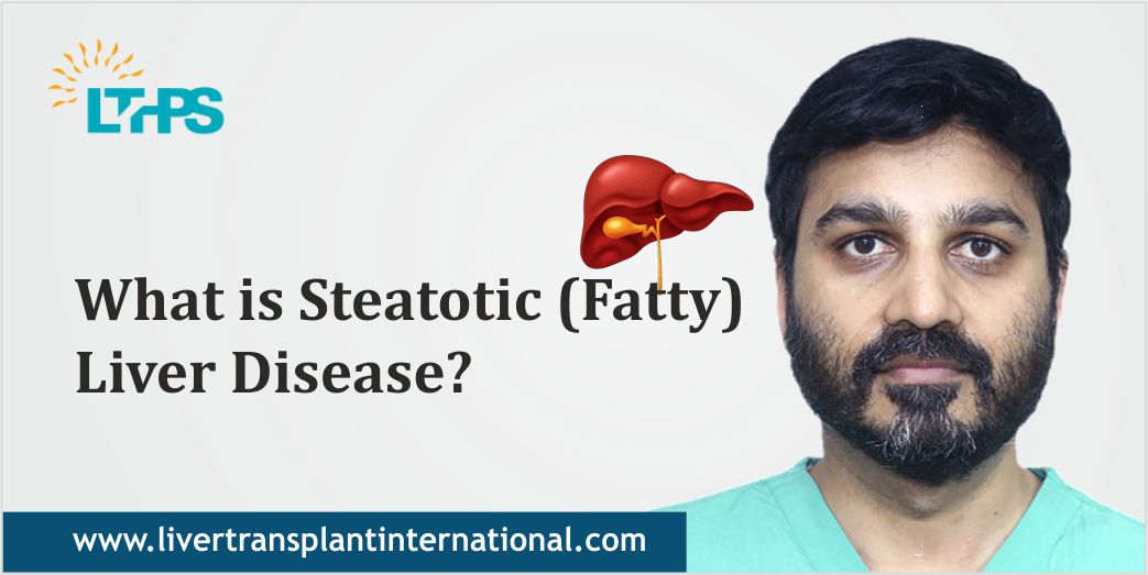 What is Steatotic (Fatty) Liver Disease? - Liver Transplant International