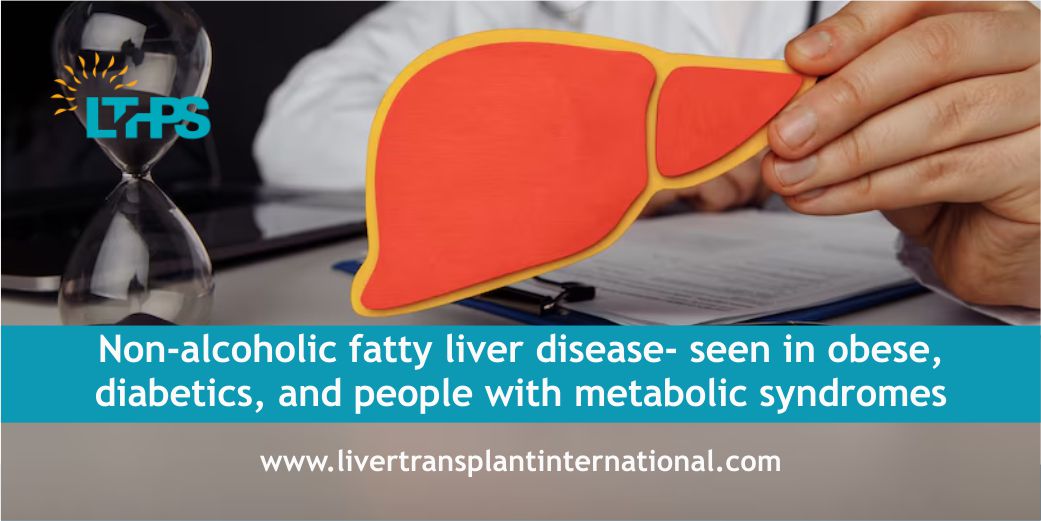 Non-alcoholic fatty liver disease- seen in obese, diabetics, and people ...