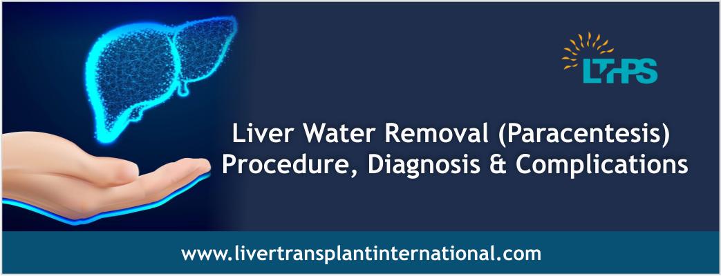 Liver water removal paracentesis