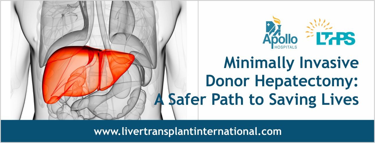 Minimally Invasive Donor Hepatectomy: A Safer Path to Saving Lives - Liver Transplant International