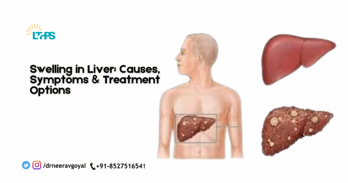 Swelling in Liver: Causes, Symptoms & Treatment Options