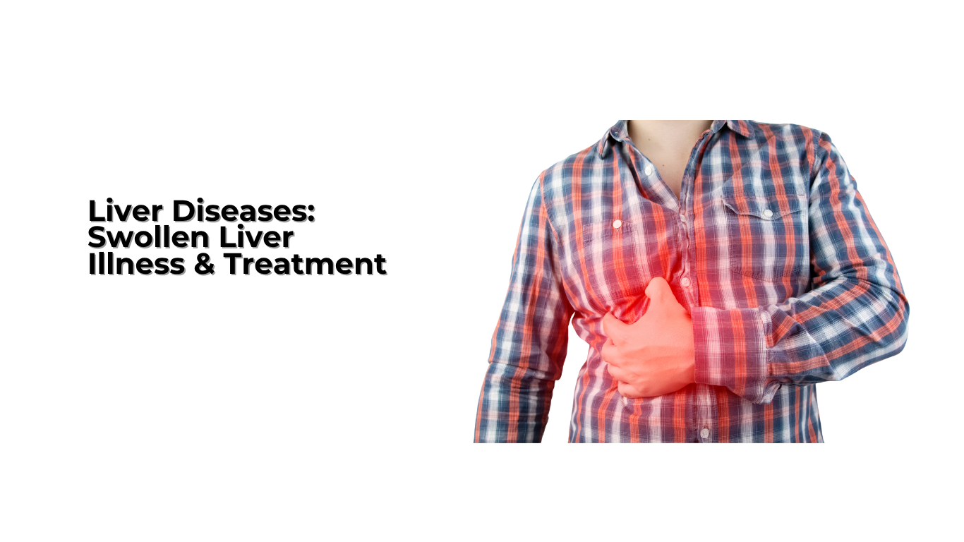 Liver Diseases: Swollen Liver Illness & Treatment