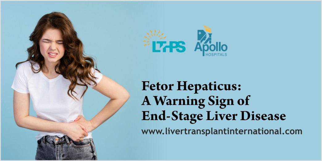 Fetor Hepaticus & End-Stage Liver Disease Guide
